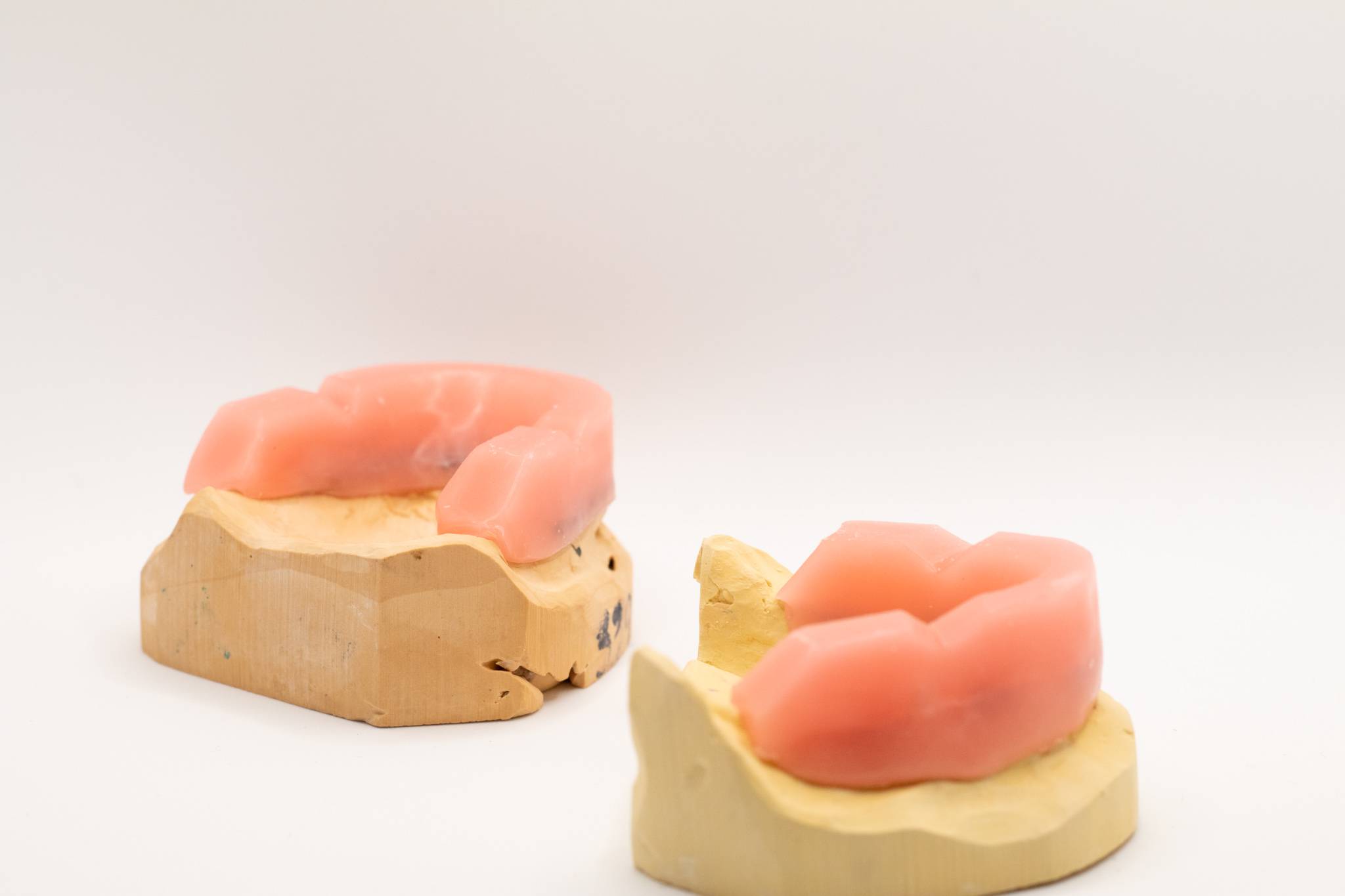 Urgent Tooth | How to Tell if Your Dentist is Good at Dentures – Tip #2 ...